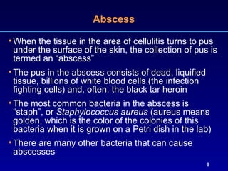Sst is | PPT