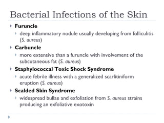 Sst is and ssis | PPT
