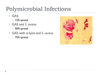 Sst is and ssis | PPT