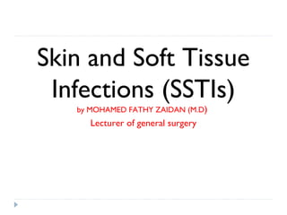 SSTI's moh zidan | PPT