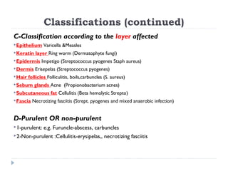 SSTI's moh zidan | PPT