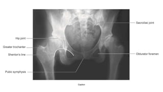 SSURFACE MARKING OF LOWER LIMB.pptx