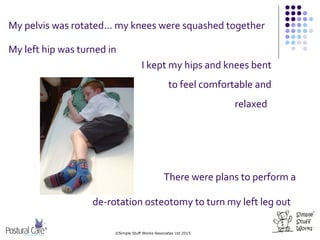 Living University of Postural Care Simple Stuff Works Connor's Story | PPT