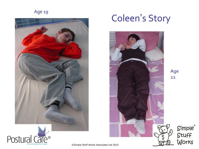 Simple Stuff Works Postural Care | PPT