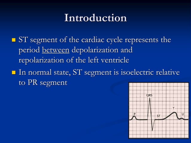 st-segment-elevations-in-ecg2-1193560461813561-5.ppt
