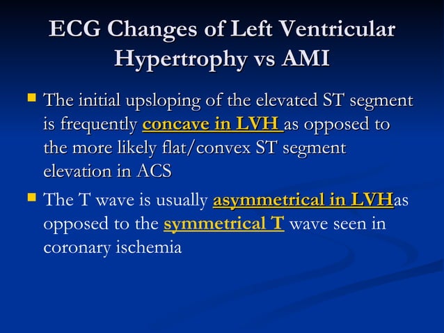 ST Segment Elevations in ECG | PPT