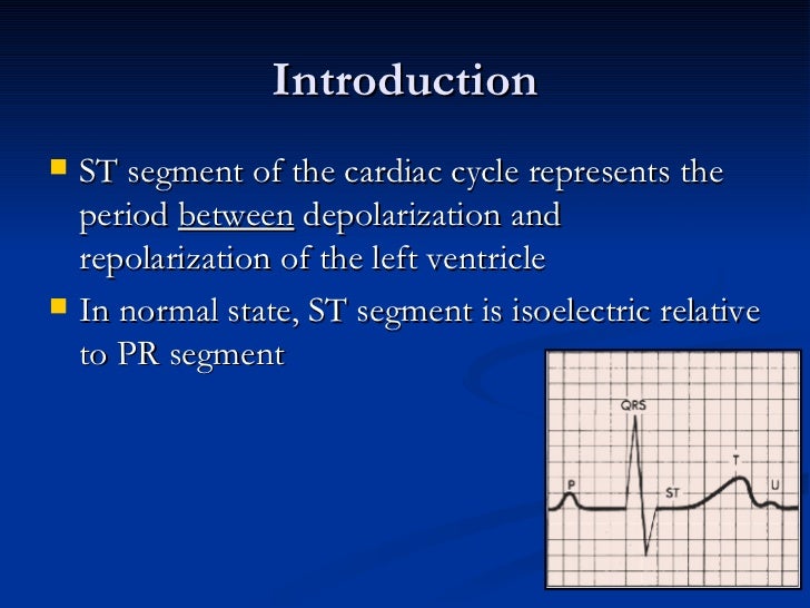 ST Segment Elevations in ECG