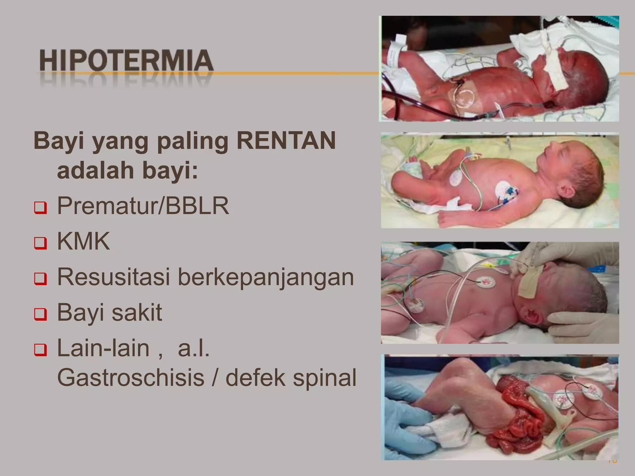 stabilisasi neonatus.pptx