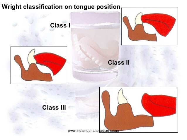 Stability /certified fixed orthodontic courses by Indian dental acade…