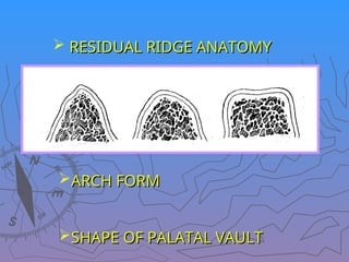 stability in complete dentures --ppt | PPT