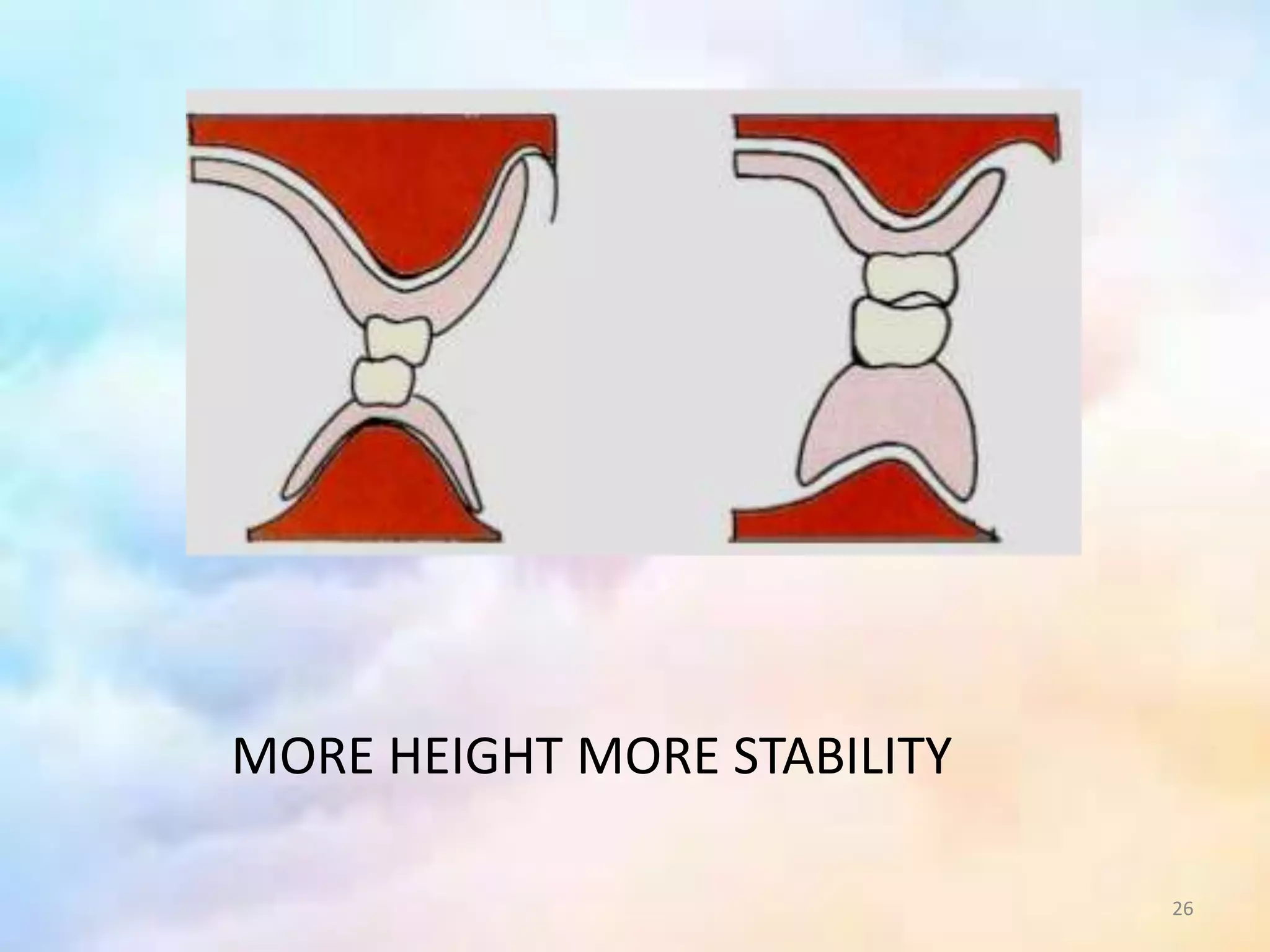 Stability and support in complete denture | PPTX