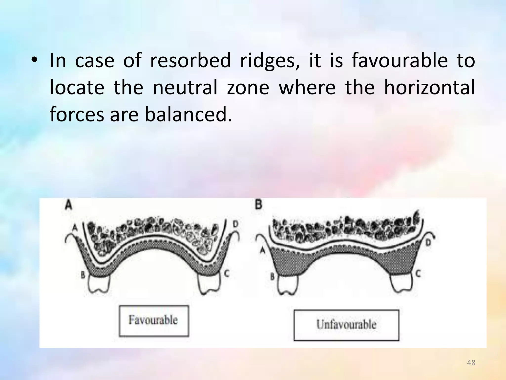 Stability and support in complete denture | PPTX