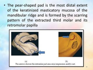 Stability and support in complete denture | PPTX