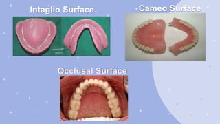 Stability in Complete Denture - by Sakshi Joshi.pptx