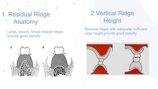 Stability in Complete Denture - by Sakshi Joshi.pptx