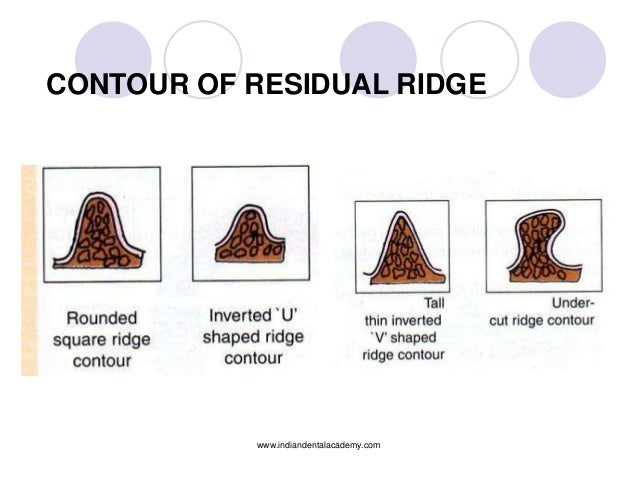 Stability in complete /certified fixed orthodontic courses by Indian