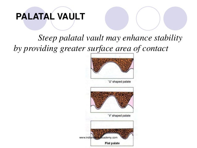 Stability in complete /certified fixed orthodontic courses by Indian