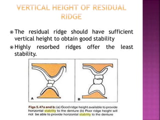 Stability in complete dentures | PPTX