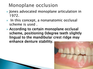 Stability in complete dentures | PPTX