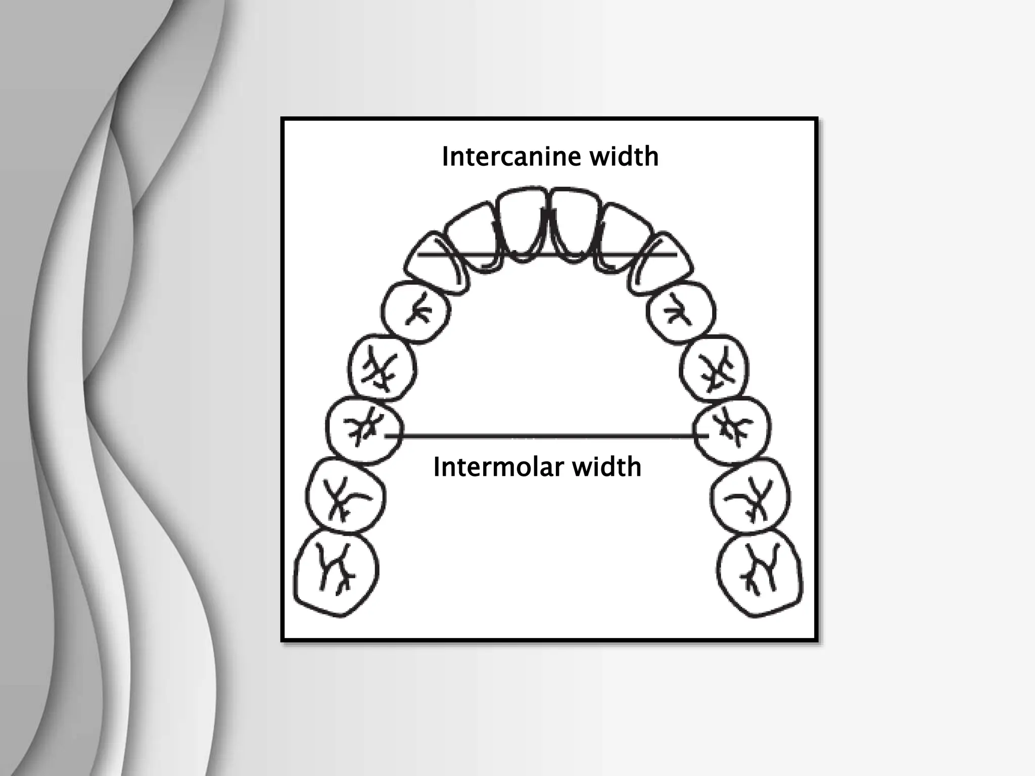 Stability of Orthopedic and Surgically Assisted Rapid Palatal Expansion ...