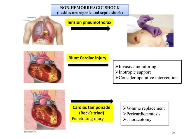 Stabilization of polytrauma patient | PPT