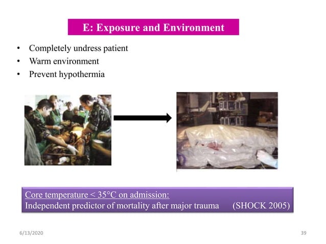 Stabilization of polytrauma patient | PPT