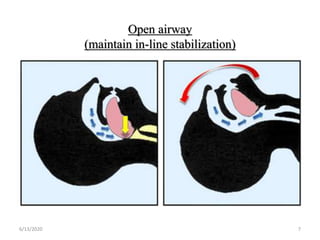 Stabilization of polytrauma patient | PPTX