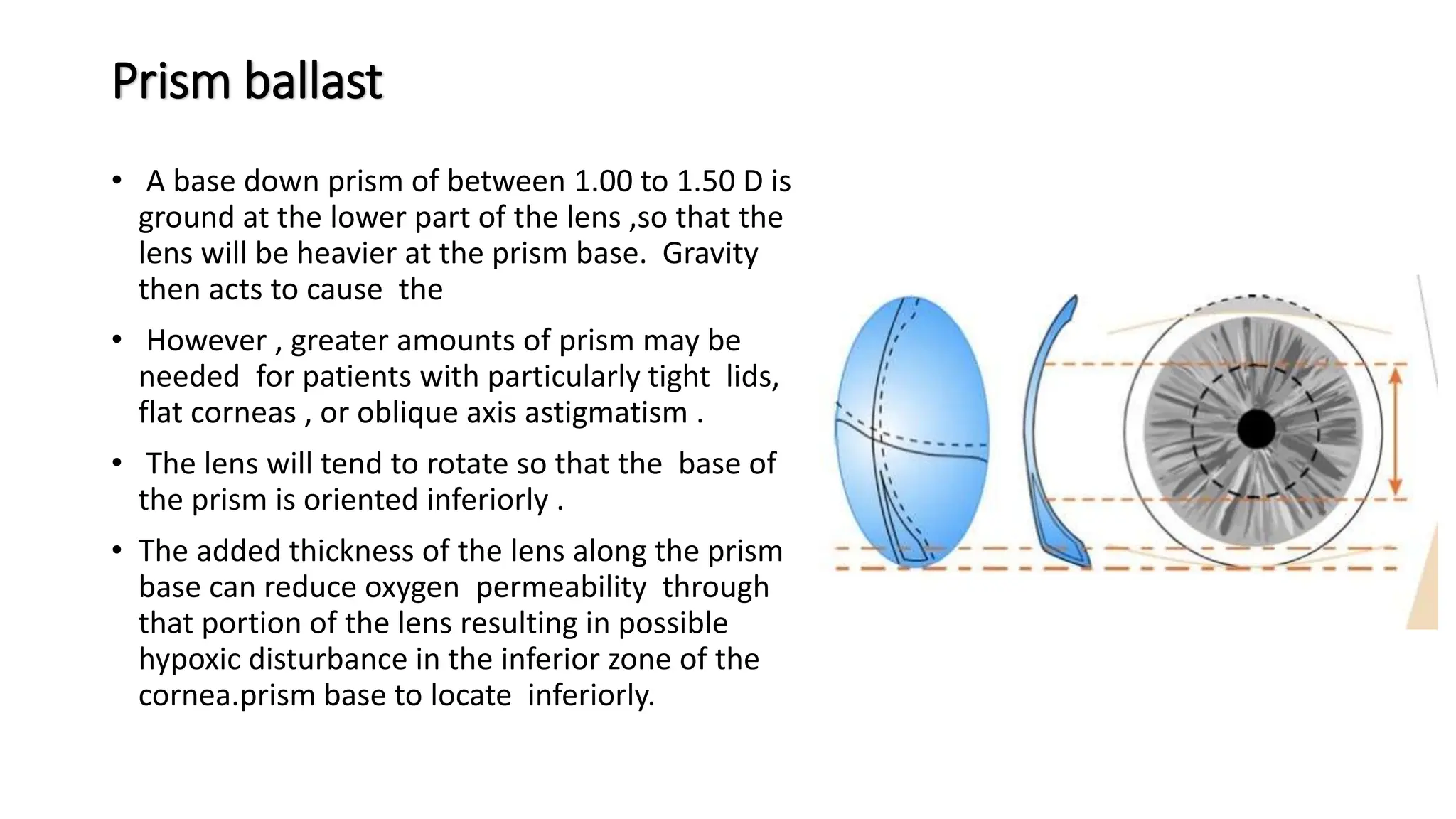 STABILIZATION PROCEDURE FOR REDUCE THE ROTATION OF CONTACT LENCE.pptx