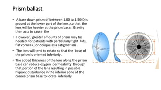 STABILIZATION PROCEDURE FOR REDUCE THE ROTATION OF CONTACT LENCE.pptx