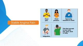 Overview of Stable Angina and Treatment (2).pptx