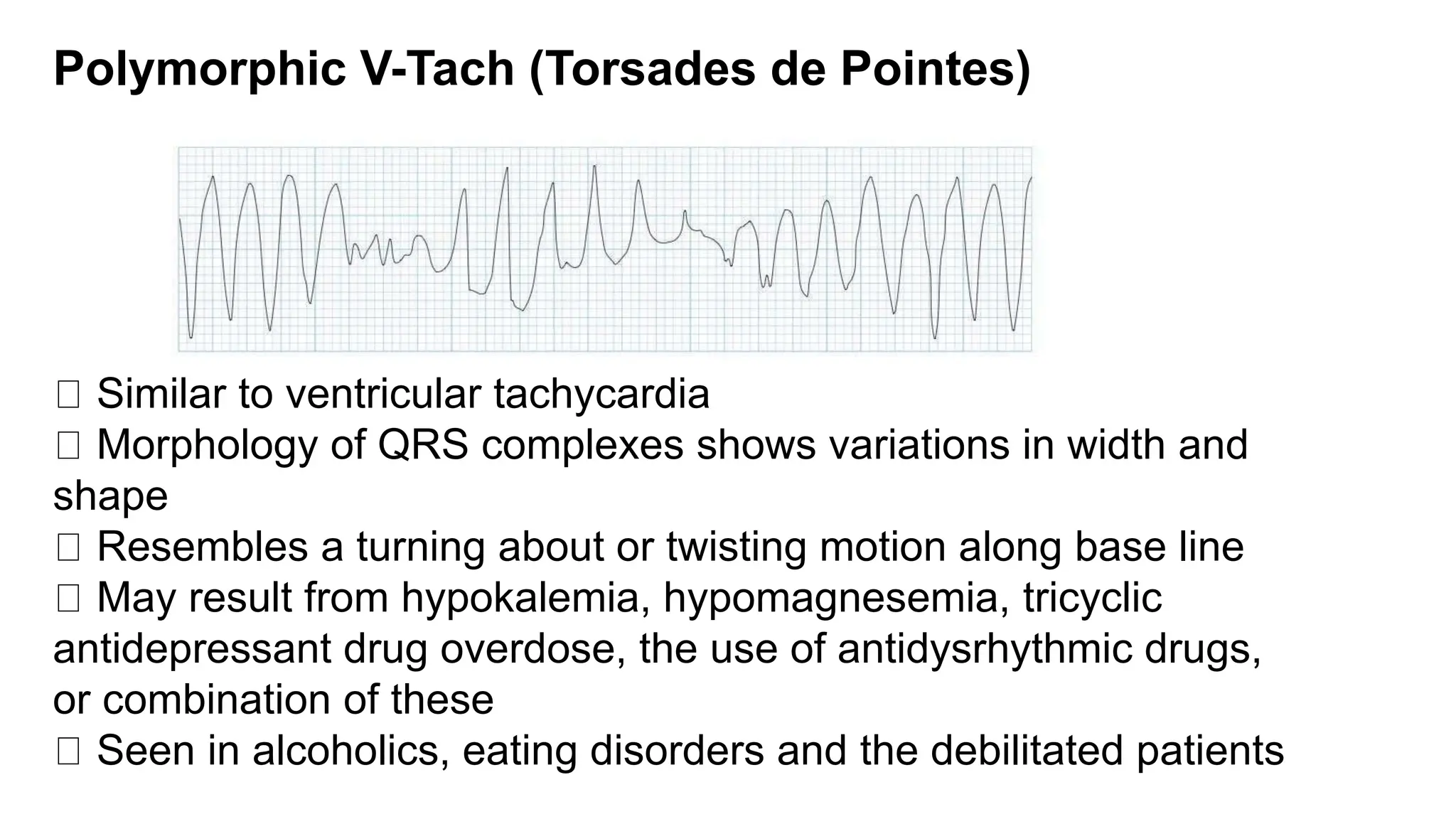 Stable & Unstabe Tachycardia.pptx
