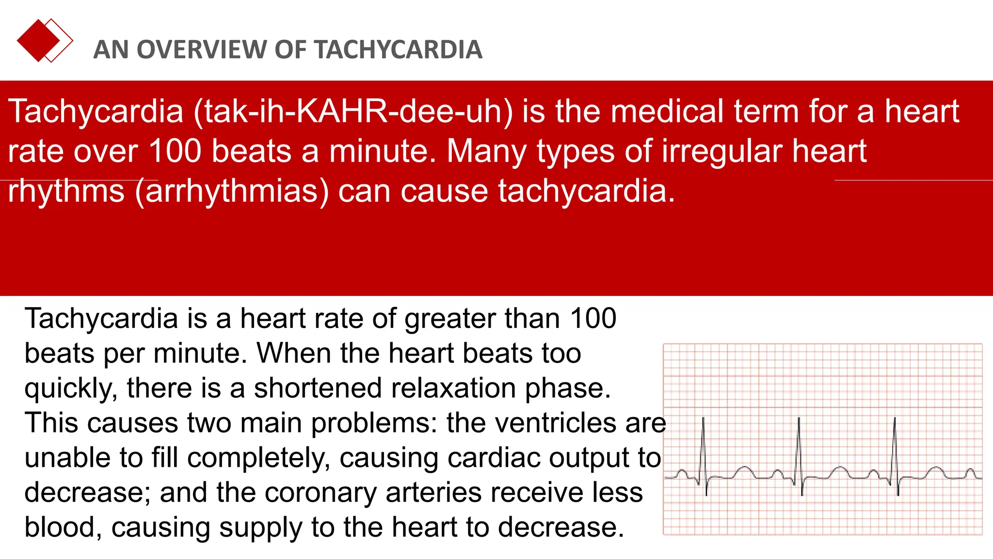 Stable & Unstabe Tachycardia.pptx