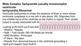 Stable & Unstabe Tachycardia.pptx
