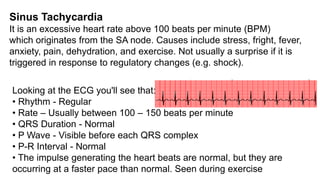 Stable & Unstabe Tachycardia.pptx