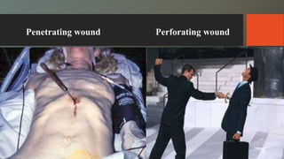 Perforating Wound