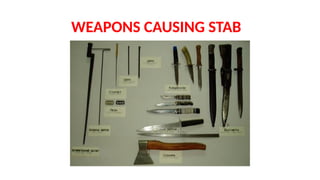 STAB WOUNDS. Forensic medicine ..injury tylepptx | PPTX