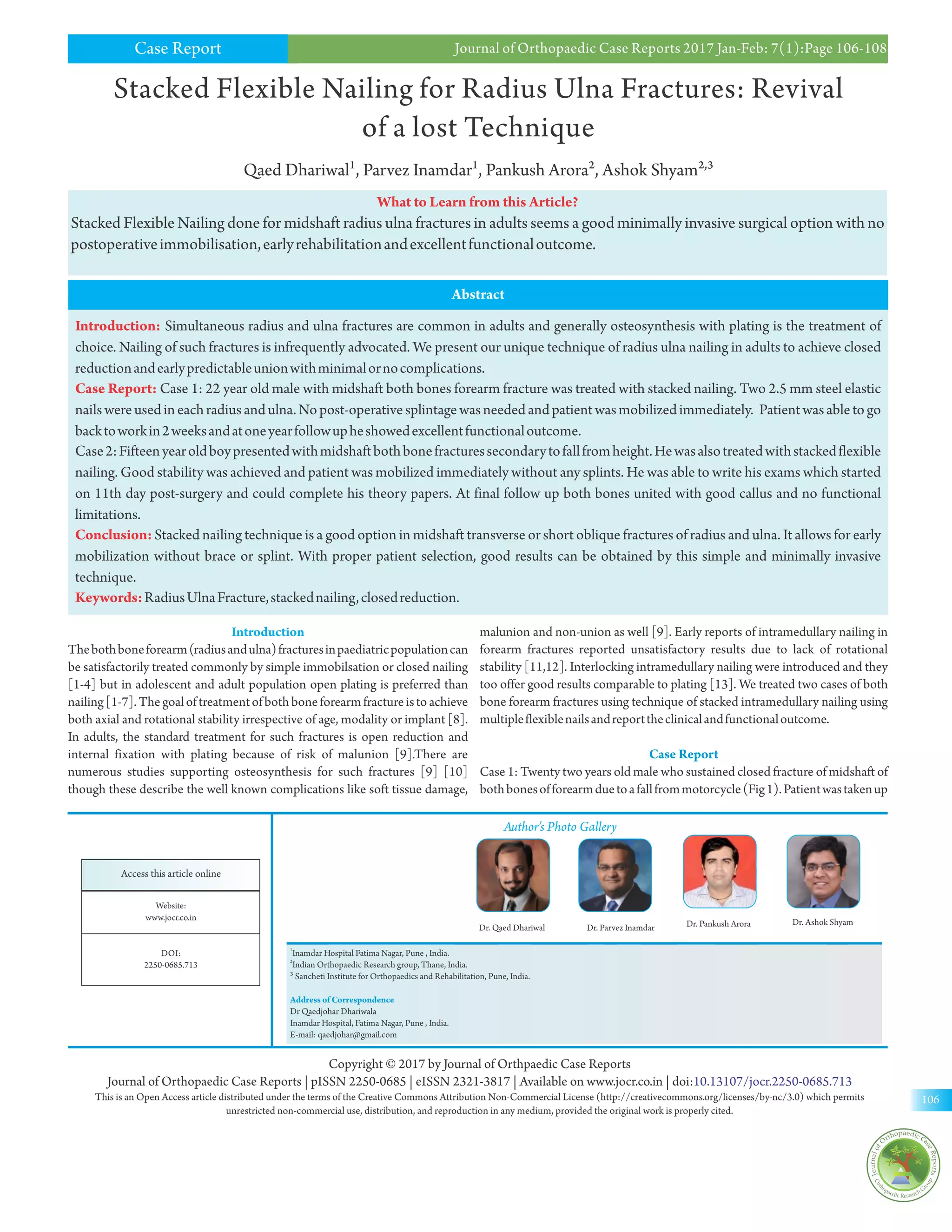 Stacked Flexible Nailing for Radius Ulna Fractures: Revival of a lost Technique | Journal of ...
