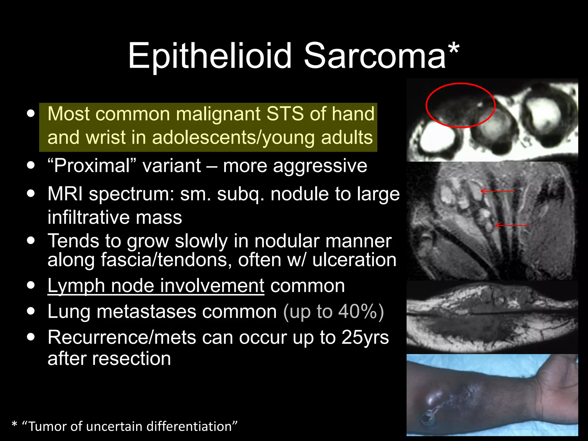 Stacy rsna v11 26 handout | PPT