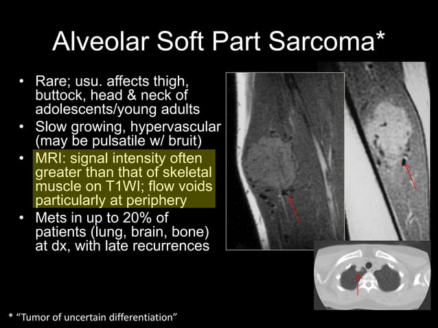 Stacy rsna v11 26 handout | PPT