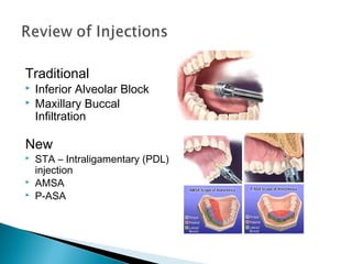 Sta description | PPT