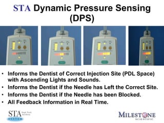 Sta Features Training Intralig.Inject. Erc | PPT