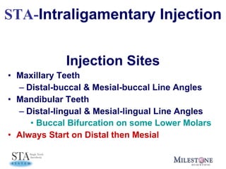 Sta Features Training Intralig.Inject. Erc | PPT