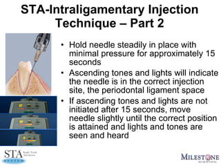 Sta Features Training Intralig.Inject. Erc | PPT