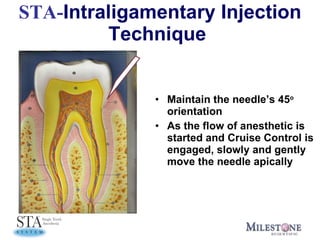 Sta Features Training Intralig.Inject. Erc | PPT