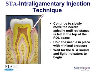 Sta Features Training Intralig.Inject. Erc | PPT