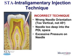 Sta Features Training Intralig.Inject. Erc | PPT