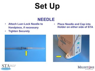 Sta Features Training Intralig.Inject. Erc | PPT