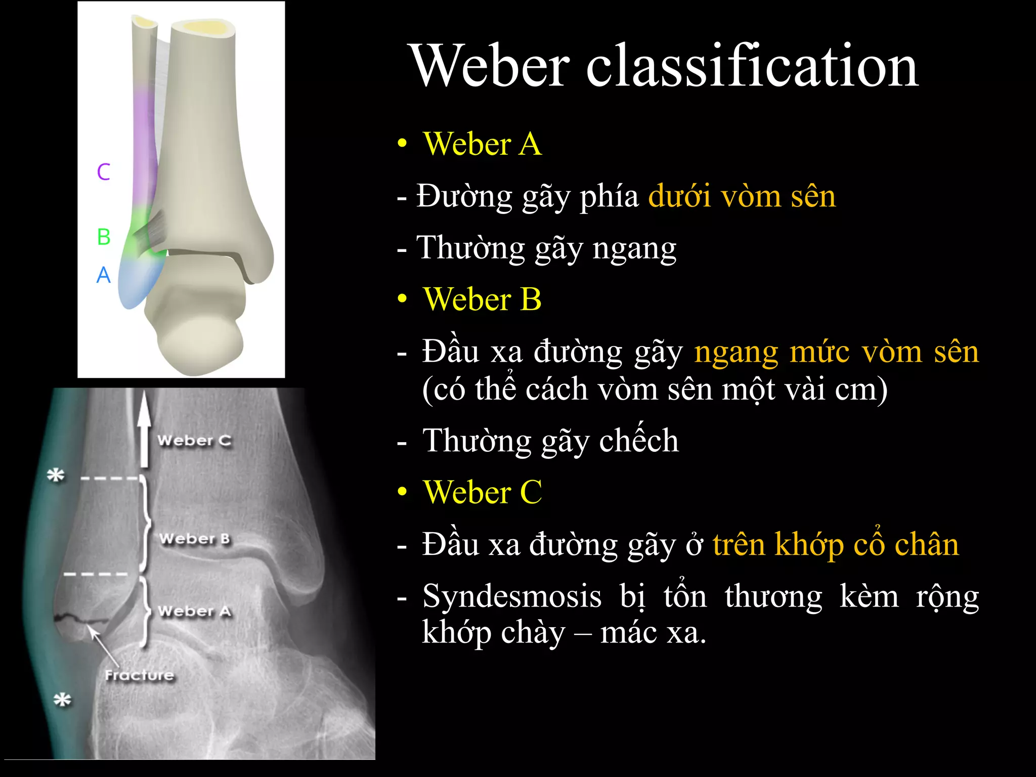 Xquang chấn thương khớp cổ chân - Ankle injury | PDF