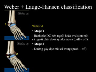 Xquang chấn thương khớp cổ chân - Ankle injury | PDF