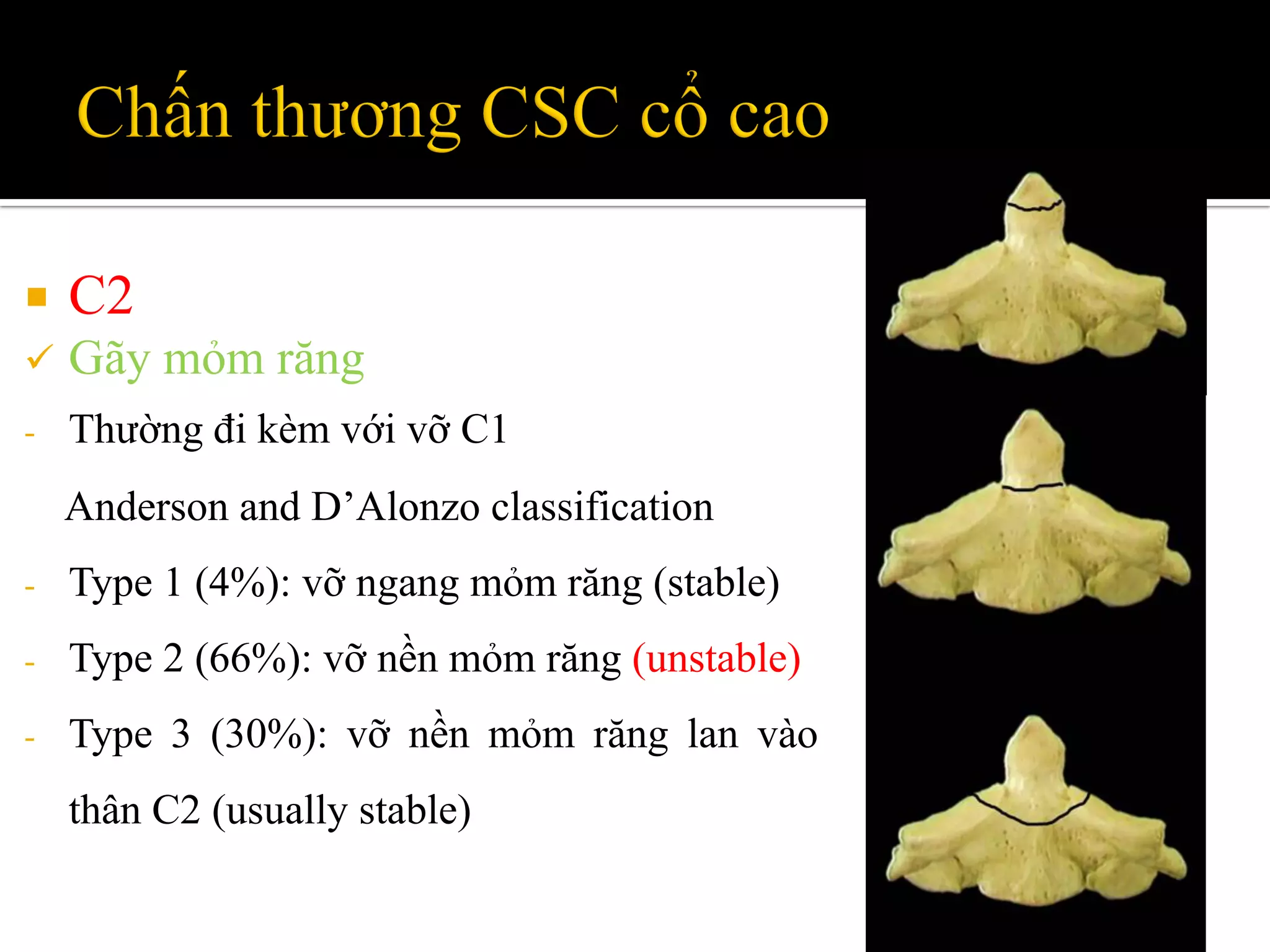 Chấn thương cột sống cổ - cervical spine injury | PDF